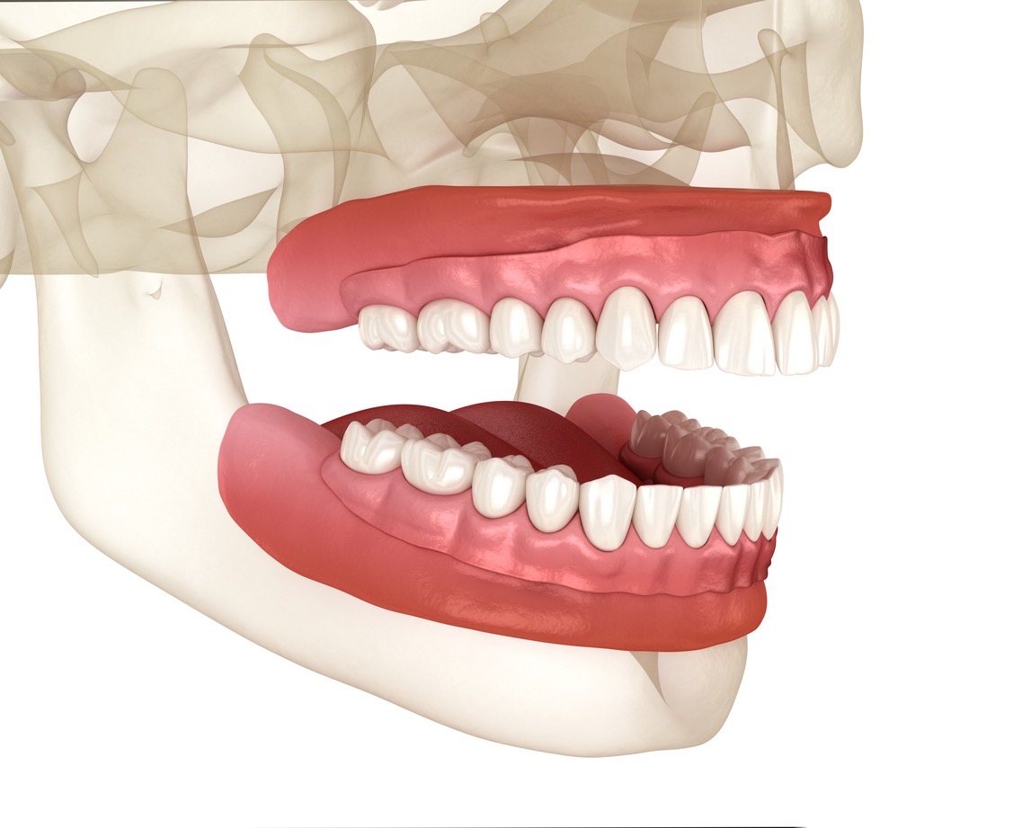 Dentures Pompano Beach FL | JB Dentistry